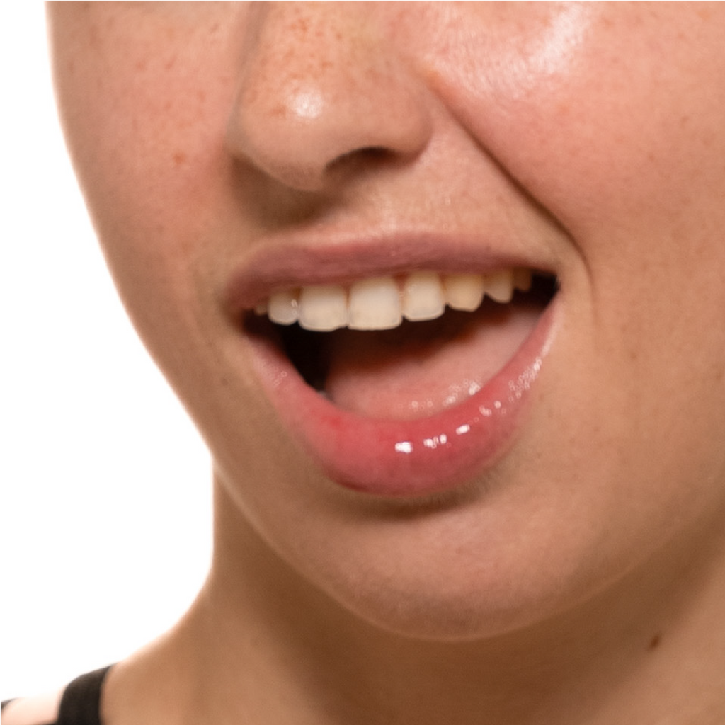 Intraoral I AND – Work Your Face